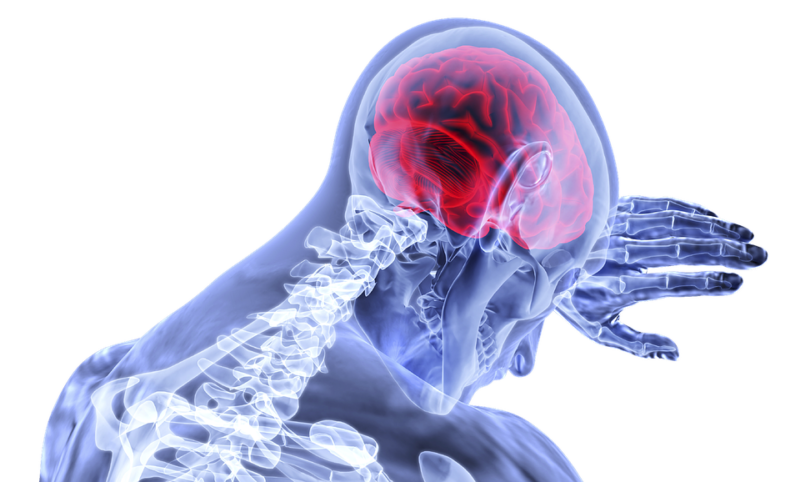 Stroke Scales - Richmond Ambulance Authority